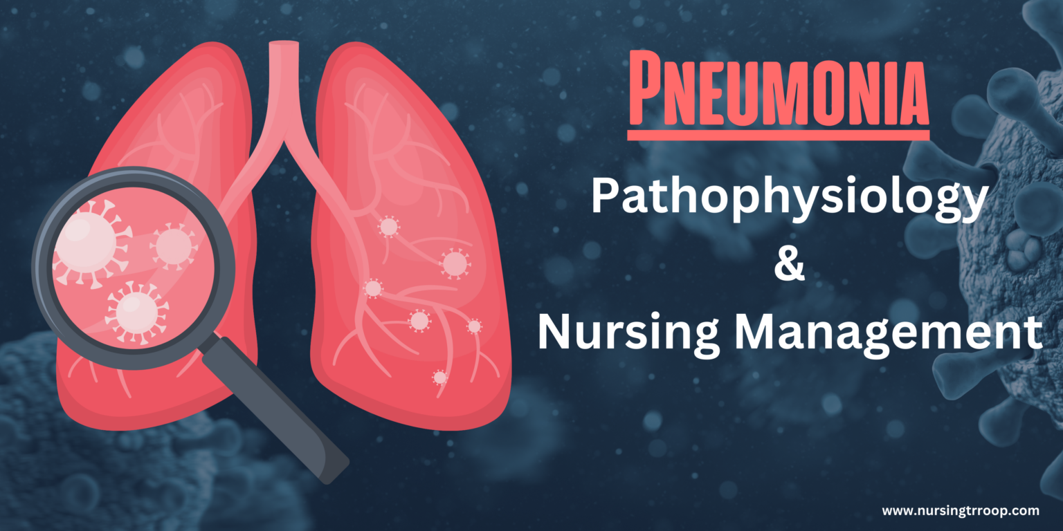 Pneumonia Pathophysiology Nursing Management Concept Map NursingTroop pneumonia-pathophysiology-nursing-management-concept-map-nursingtroop
